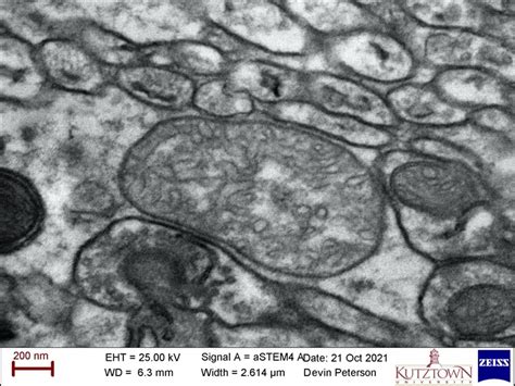 Nerve Cell Electron Microscope