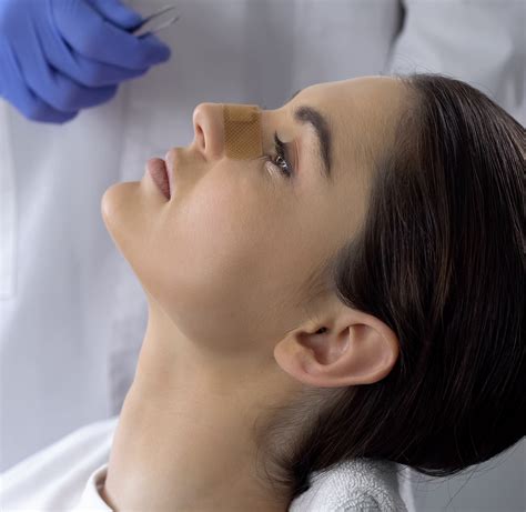 Nasal Fractures Southern Ent Associates Nasal Fractures Southern Ent Associates