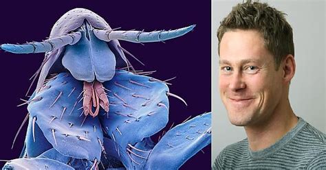 The Human Flea Looks Like A Human Album On Imgur