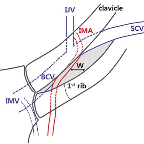 A B A 44 Year Old Man With An Apical Lung Nodule Non Contrast Ct Download Scientific Diagram