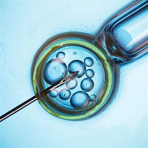 Sperm DNA Fragmentations A Comprehensive Guide IVF Conceptions