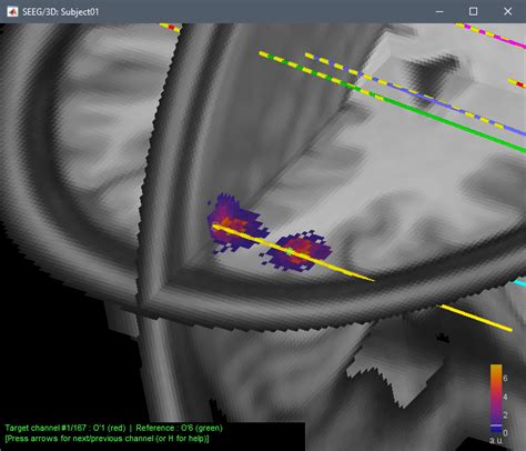 display leadfield as heatmap within brainstorm · issue 585