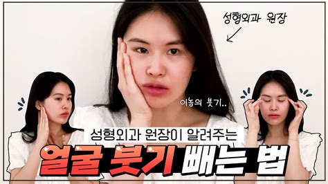 성형외과 원장의 얼굴 붓기 빼는 법😎 효과 100 보장 야식 먹은 날 시술 후 붓기 생리 전후🤢 Youtube