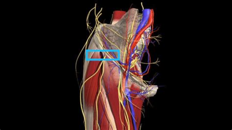 Lateral Femoral Cutaneous Nerve Block For Meralgia Paresthetica