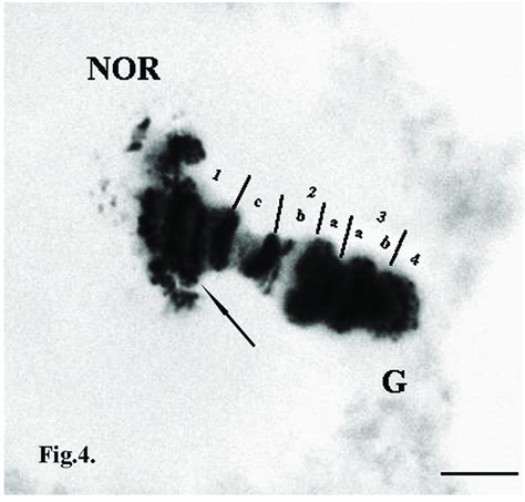 Polytene Chromosome G The Chromosome Was Divided To Sections In Download Scientific Diagram