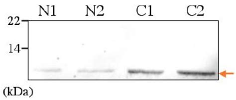 Western Analysis Of The ApoA II Levels In Two Pairs Of Download Scientific Diagram