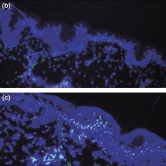 Effects Of Ultraviolet A UVA Radiation On Free Nerve Endings A Download Scientific Diagram