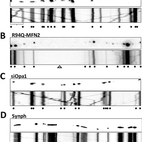 Abnormal Distribution Of Axonal Mitochondria Correlates With Axonal Download Scientific Diagram