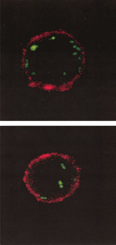 Opsonization Of Bacteria By J774a1 Cells Determined By Confocal Download Scientific Diagram Opsonization Of Bacteria By J774a1 Cells Determined By Confocal Download Scientific Diagram