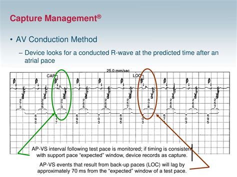 Ppt Pacemaker Automatic Features Module 10 Powerpoint Presentation Free Download Id 976868