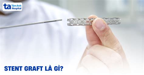 Stent Graft Là Gì Vai Trò Cấu Tạo Và Chức Năng Hoạt động