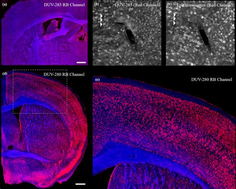 Red Fluorescent Nissl Body Imaging Using The Duv Microscope With A C Download Scientific