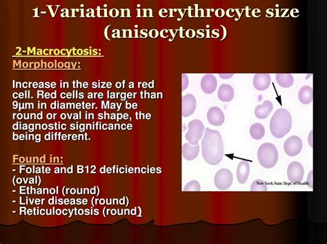 Ppt Rbcs Abnormal Morphology Powerpoint Presentation Free Download
