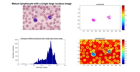 biomedical signal and image processing projects using matlab and