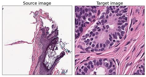 Preprocessing Hande Stain Normalization — Pathml 300 Documentation
