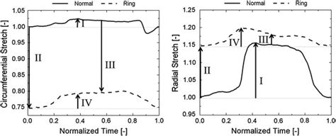 A Typical Example Showing The Dynamic Changes In The Circumferential Download Scientific