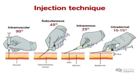 Types Of Injection Pptx