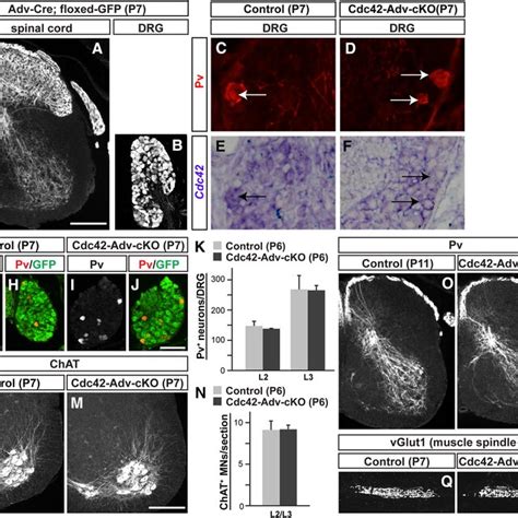 Axonal Projections And Presynaptic Terminals Of Proprioceptive Sensory