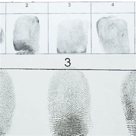 Fingerprint Patterns A Fingerprint Of Right Hand 1 Thumb Loop Download Scientific Diagram