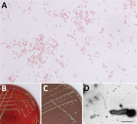 Figure Haematospirillum Jordaniae Cellulitis And Bacteremia Volume