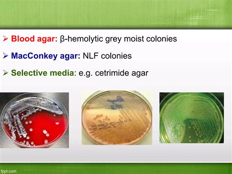 Gnnf Pseudomonas And Acinetobacter Ppt