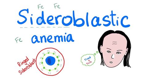 What Is Sideroblastic Anemia And How Is It Diagnosed Flash Uganda Media