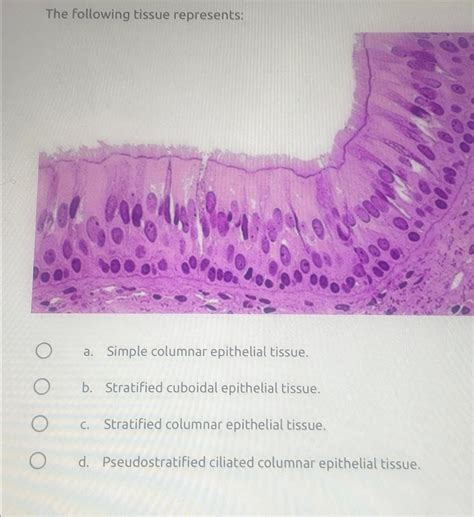 Solved The Following Tissue Represents A ﻿simple Columnar