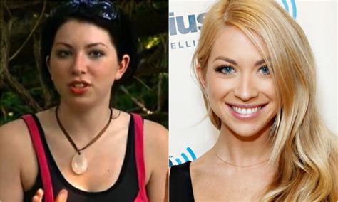 Celebrity Plastic Surgery 30 Before And After Pics Stylecaster