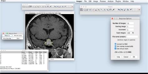 Volume Measurement Example Download Scientific Diagram