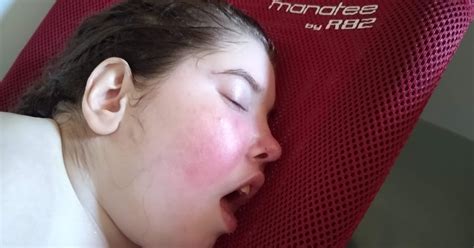 Room For More Hyperpyrexia