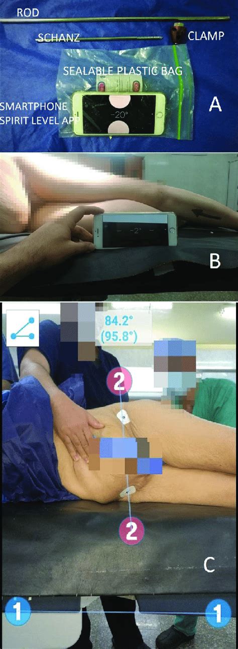 Instrument Used Table And Patient Position Adjustment A Instrument Download Scientific