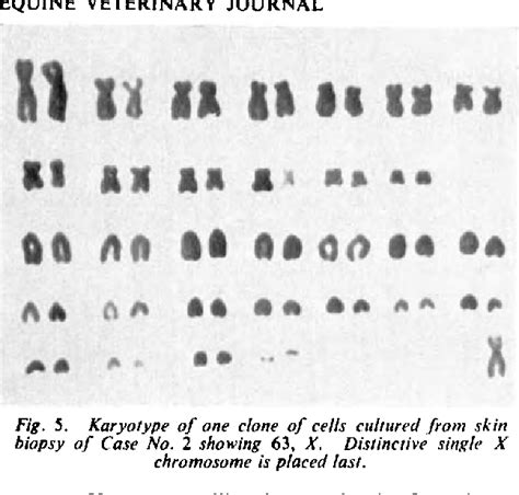xo chromosome abnormality the multi omic landscape of sex chromosome