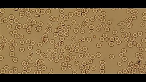 Compatible Cross Matching Under A Microscope Youtube