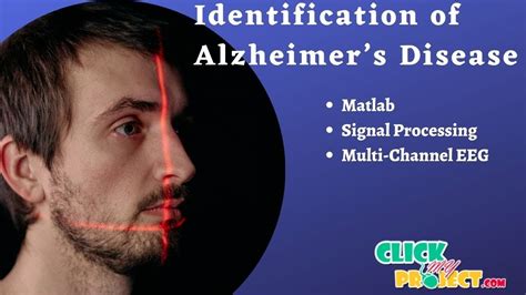 matlab signal processing project alzheimers disease based on latent