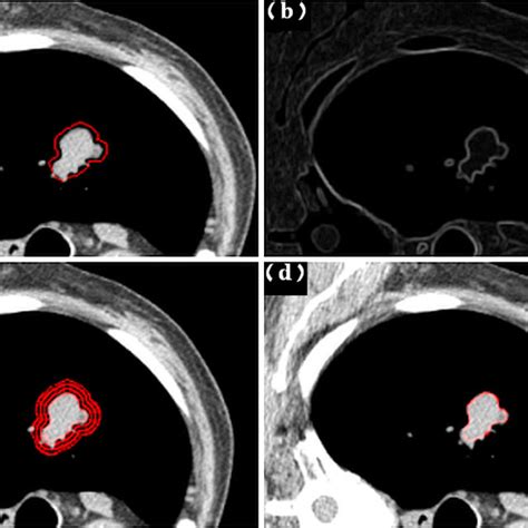Illustration Of The Partial Volume Correction Process A Original Scan Download Scientific