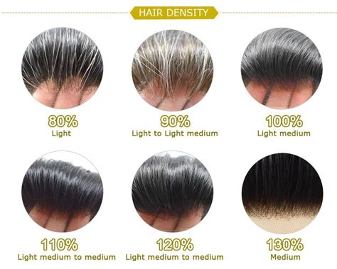 Scalp Hair Density Chart Ubicaciondepersonas Cdmx Gob Mx