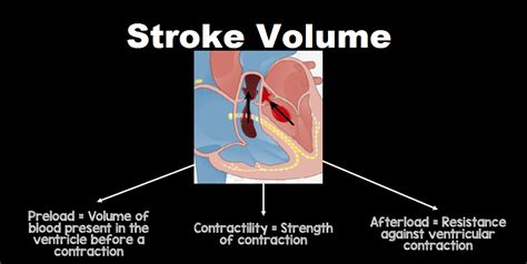 How Is Stroke Volume Calculated