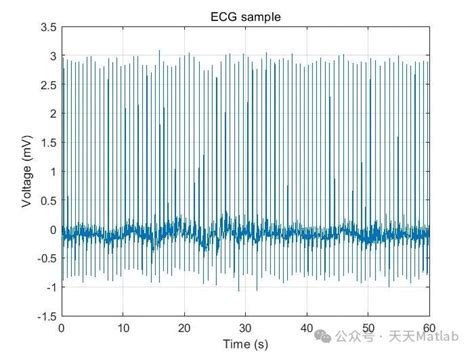 【心电信号ecg】基于快速傅里叶变换和功率谱ecg信号频谱分析密度附matlab代码 Csdn博客