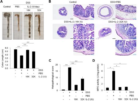 Effect Of Low Dose Il 2 On The Histopathology Of Dss Induced Colitis
