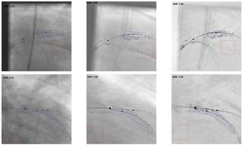 Algorithms Special Issue Algorithms For Biomedical Image Analysis And Processing