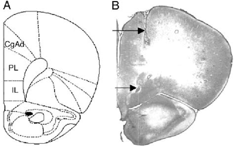 Figure 1 From Coding For Spatial Goals In The Prelimbic Infralimbic