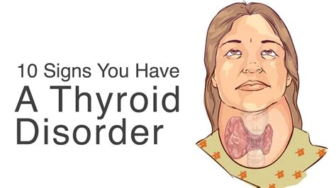 Thyroid Disorders In Women Hashimotos Disease Pnswg