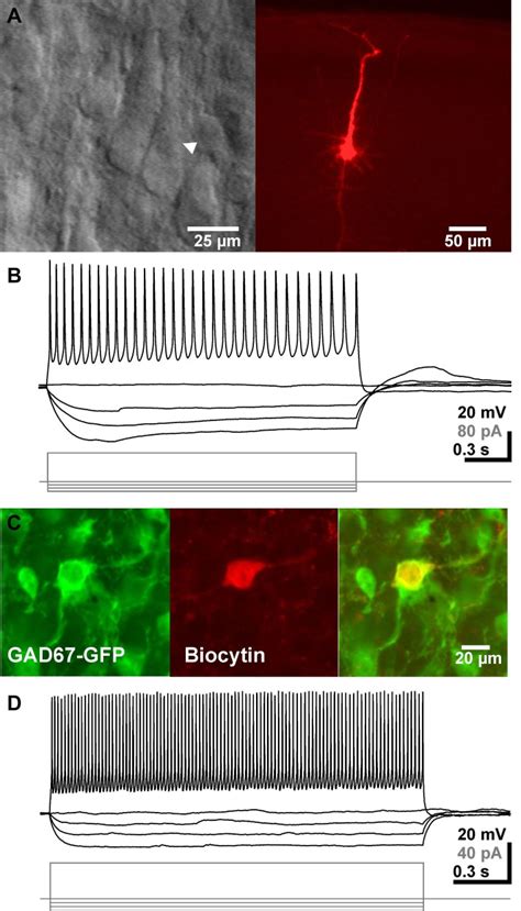 Identification And Basic Electrophysiological Properties Of Neocortical Download Scientific