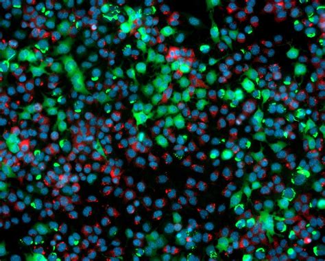 Open Source Microscopy Tools For Image Processing And Analysis
