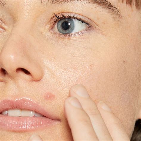 Deep Breakout Liquid Patch Dermalogica Au