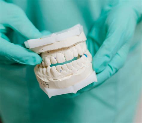 Everything You Should Know About Underbite