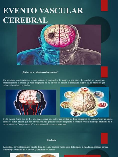 Evento Vascular Cerebral Mi Parte Pdf Carrera Isquemia