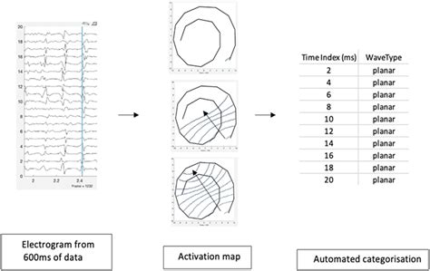 RETROmapping A Novel Algorithm Automating Wavefront Categorization Using Activation Mapping