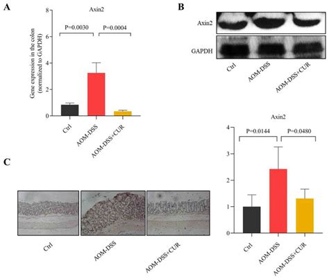 Curcumin Suppresses Colorectal Tumorigenesis Via The Wntβ‑catenin Signaling Pathway By
