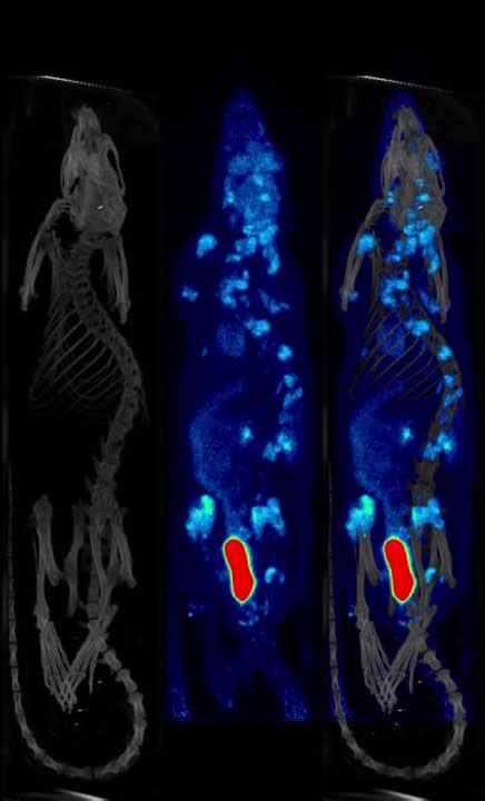 Bruker Preclinical Imaging On Linkedin Detection Of Bone And Brain Metastases In Breast Cancer